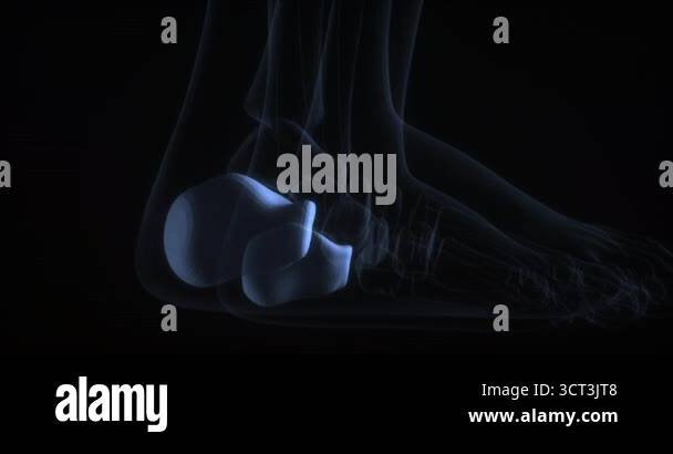 Calcaneus bones in human body. X Ray. Loop Stock Video Footage - Alamy