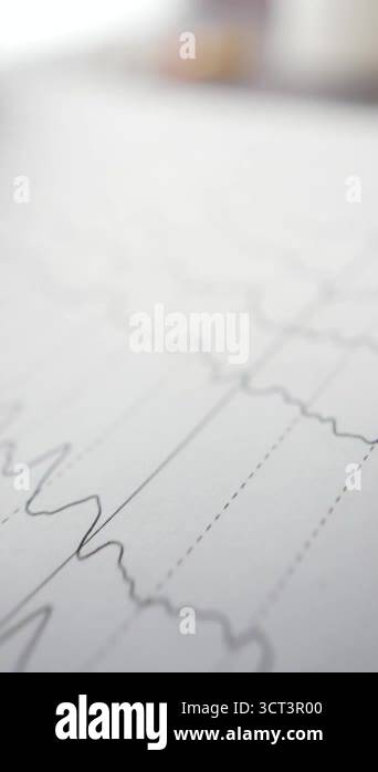 Close up eeg graph Stock Videos & Footage - HD and 4K Video Clips - Alamy