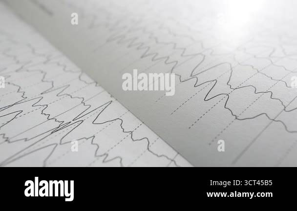 Brain technology eeg Stock Videos & Footage - HD and 4K Video Clips - Alamy