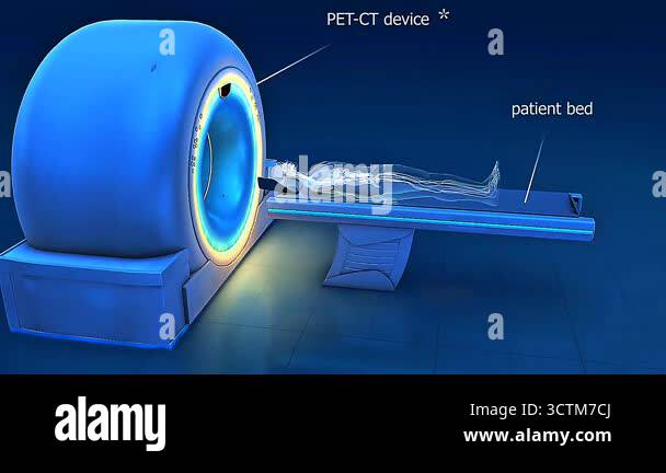 Modern pet ct room scanner Stock Videos & Footage - HD and 4K Video ...