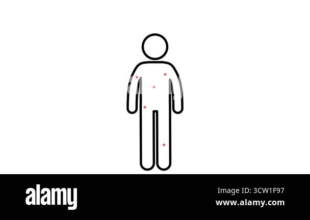 Stick figure man suffering from chickenpox infection illustration Stock ...