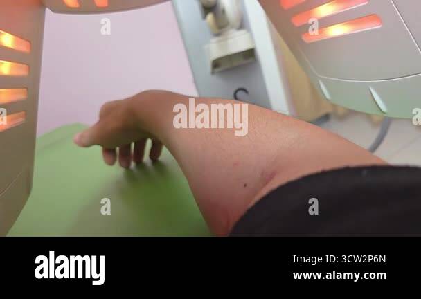 A man doing physiotherapy using an infrared lamp for arm Stock Video ...