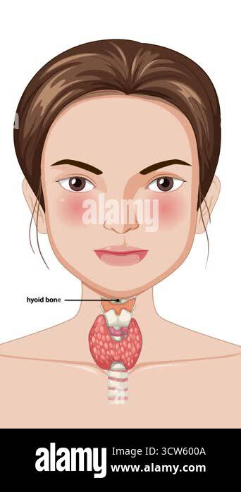 Illustration of thyroid gland anatomy with labeled parts, highlighting ...