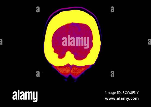 Detailed MRI Scan of the Human Brain Showcasing Complex Structures with ...