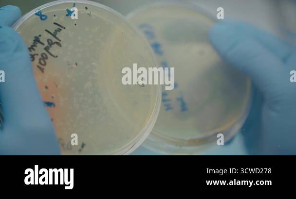 Petri dishes growth experiment Stock Videos & Footage - HD and 4K Video ...