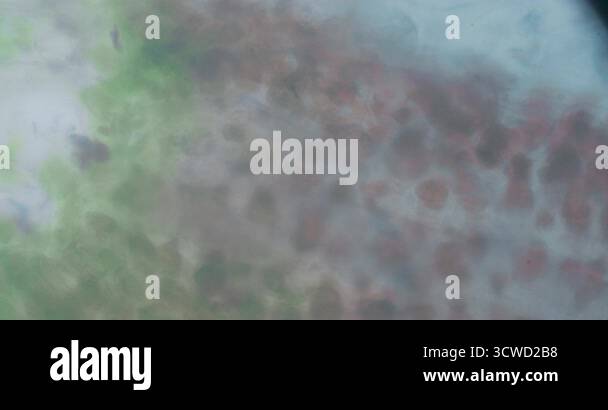 A detailed close-up view of a plant leaf observed under a microscope ...