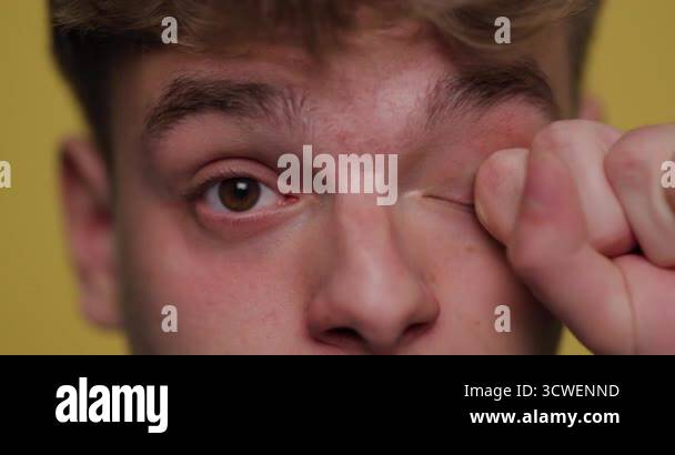 A young man is seen rubbing his eye with a puzzled expression while ...