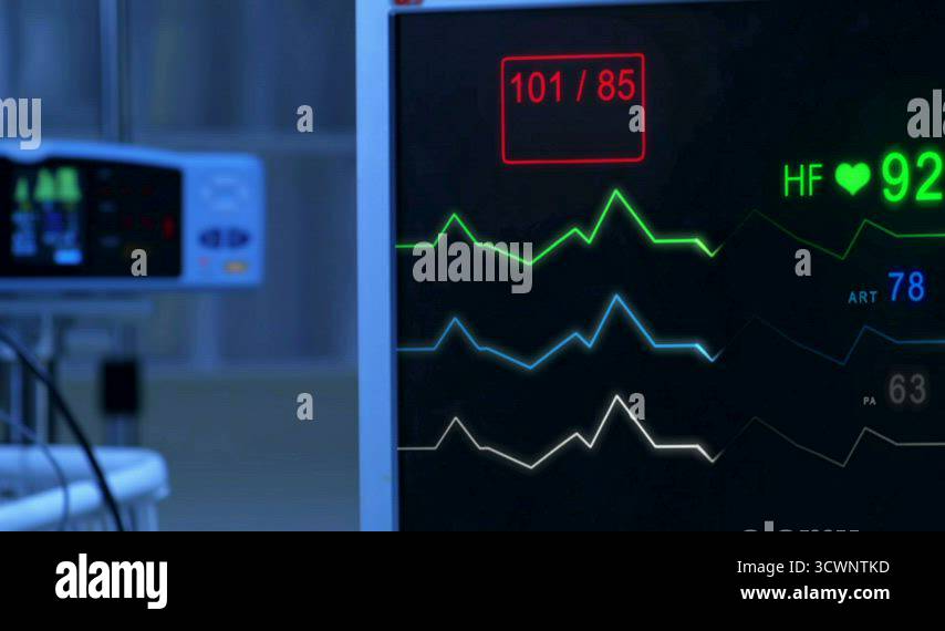 Cinemagraph of pulse checking E.C.G Monitor with pulse Stock Video ...