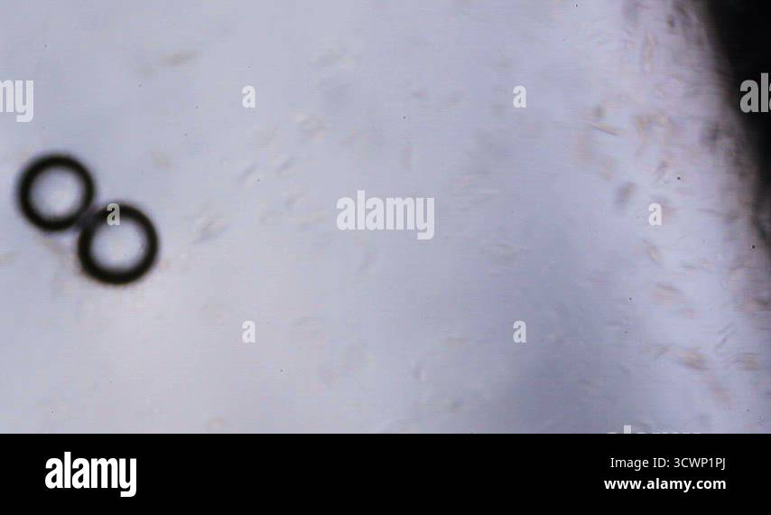 Water bubbles under the microscope Stock Video Footage - Alamy