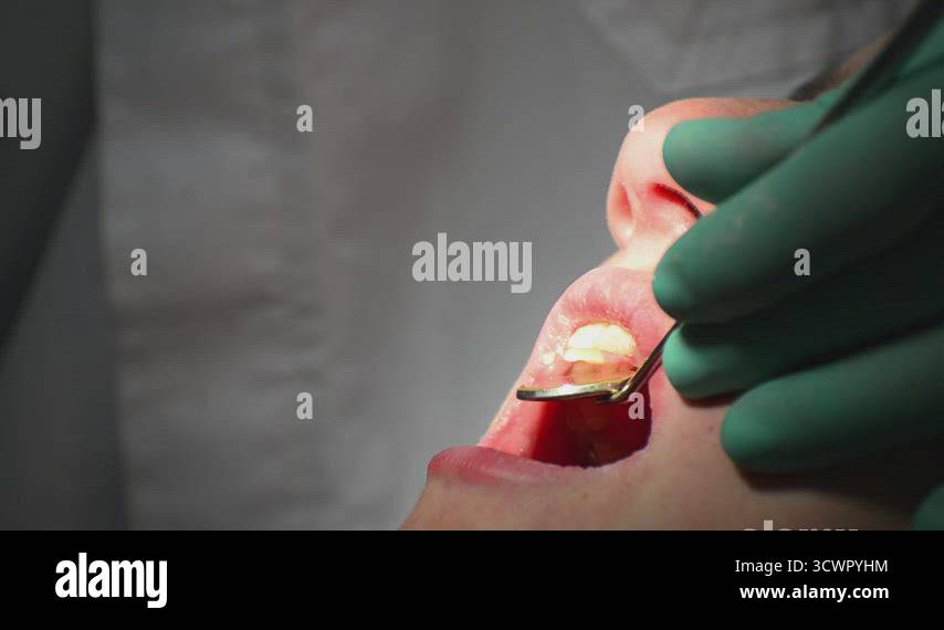 Teeth check up Stock Videos & Footage - HD and 4K Video Clips - Alamy