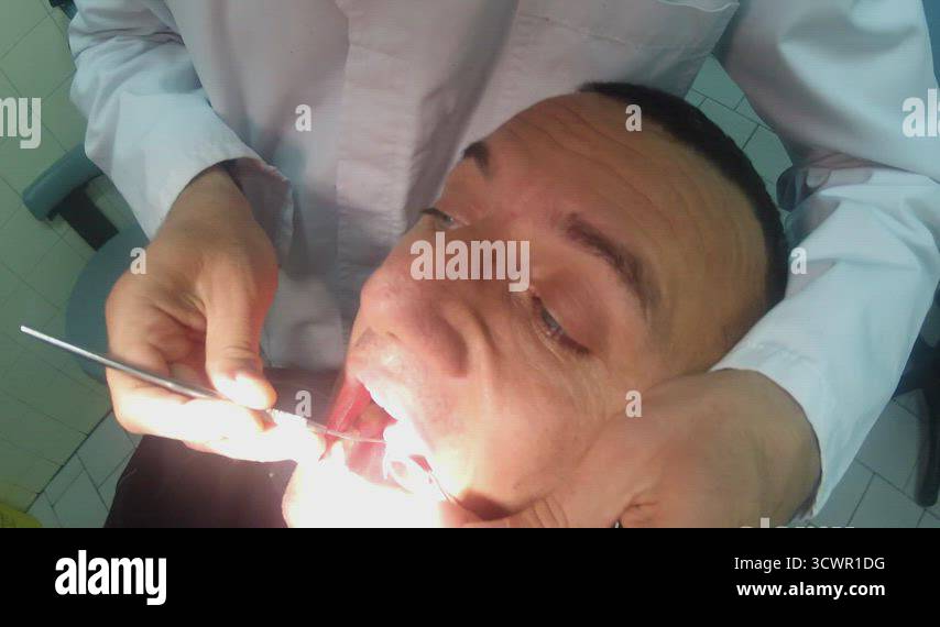 dentist teeth check up for gum gingivitis and tooth caries Stock Video ...