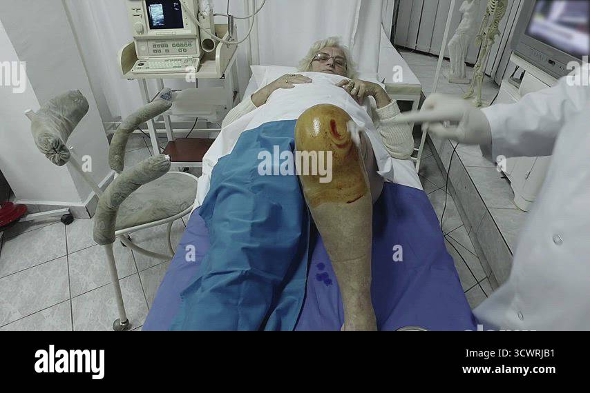 Knee disinfection cleansing process before inferior injection for ...