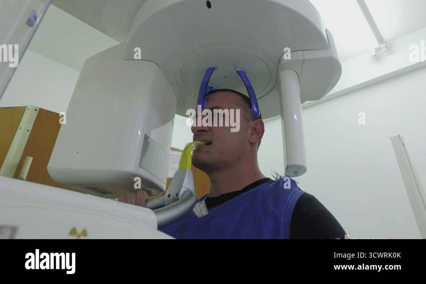 Patient using panoramic xray machine Stock Videos & Footage - HD and 4K ...