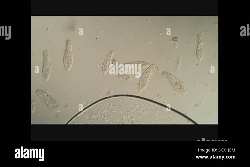 unicellular slipper animals swim in drops of water under the microscope ...
