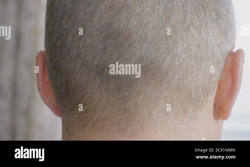 Man touching and stroking head nape while thinking close up. Headache ...