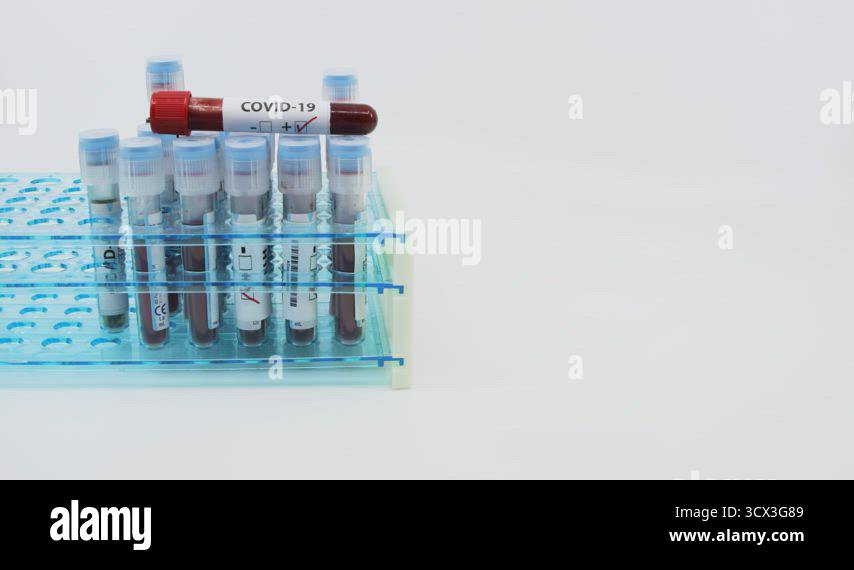 Dubai-UAE-Circa 2020:Doctor showing bottle of medicine for covid-19 ...