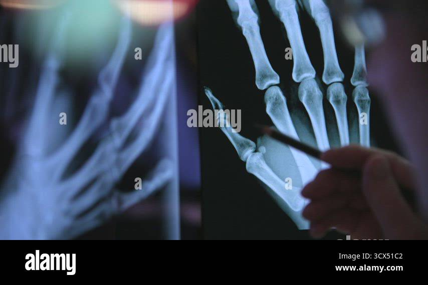 CU R/F Doctor examining scan of hand for damage and disease, High ...