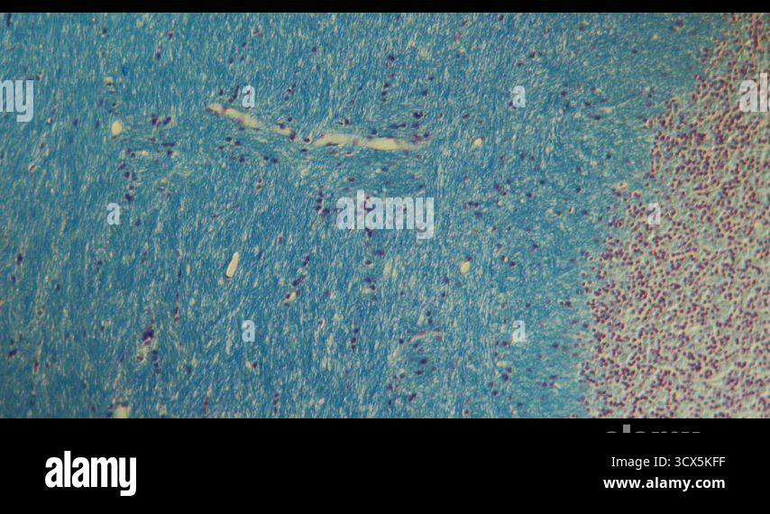 Central nervous system CNS of the rat in cross section Stock Video ...