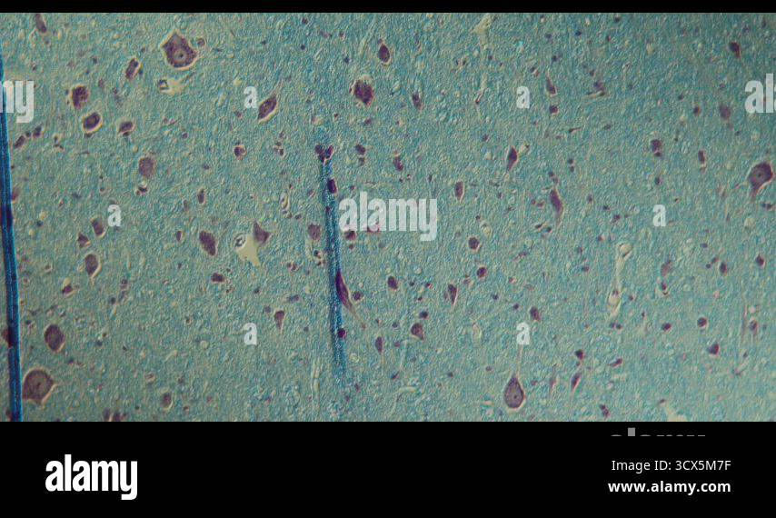 Spinal nerves of the rat in cross section Stock Video Footage - Alamy