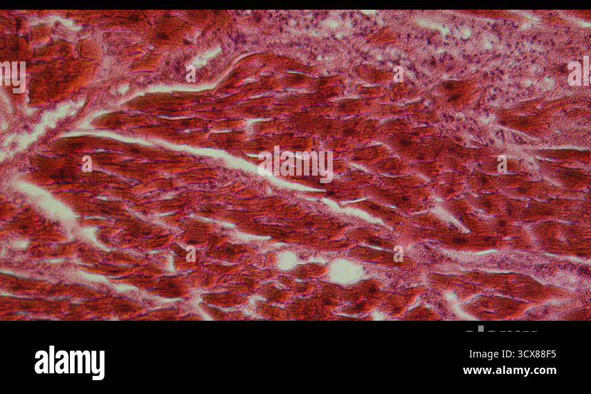 An ovary Stock Videos & Footage - HD and 4K Video Clips - Alamy