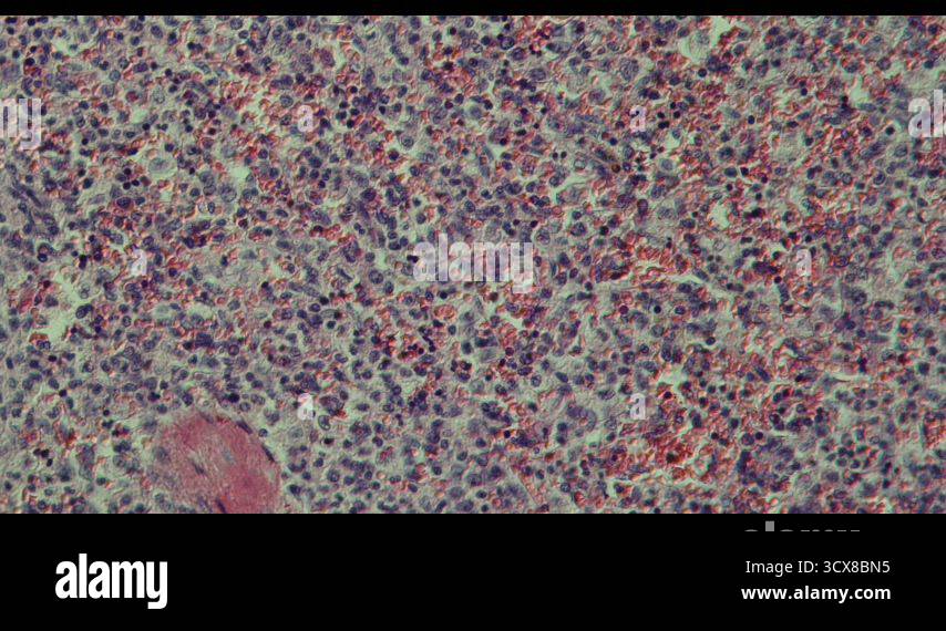 Liver gas burn Stock Videos & Footage - HD and 4K Video Clips - Alamy