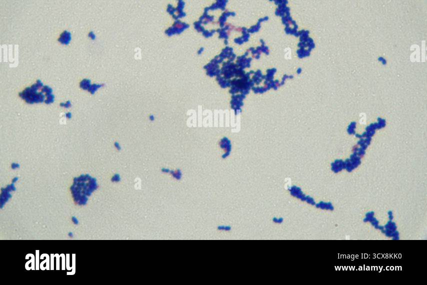Microscopic view streptococcus Stock Videos & Footage - HD and 4K Video ...