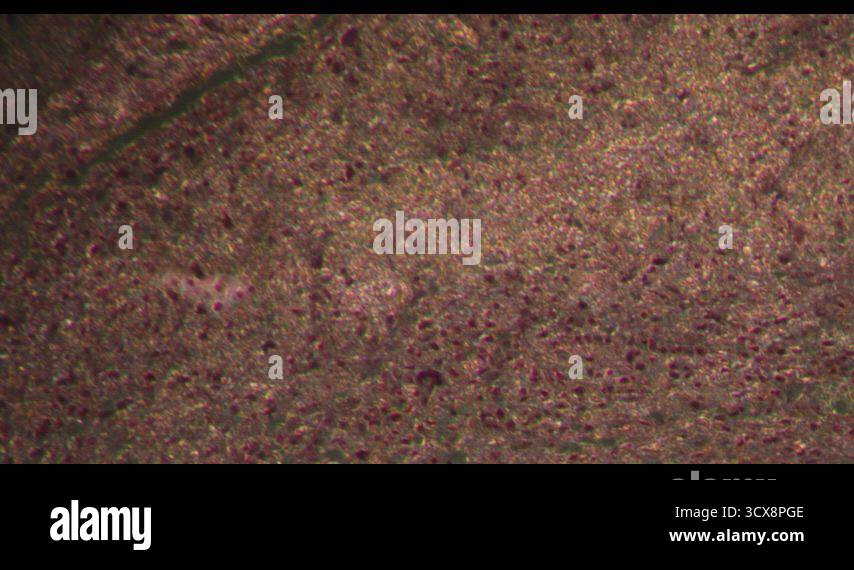 Heart muscle scar in Darkfield Stock Video Footage - Alamy