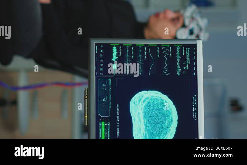 Vertical video: Neurologist doctor analysing nervous system using eeg ...