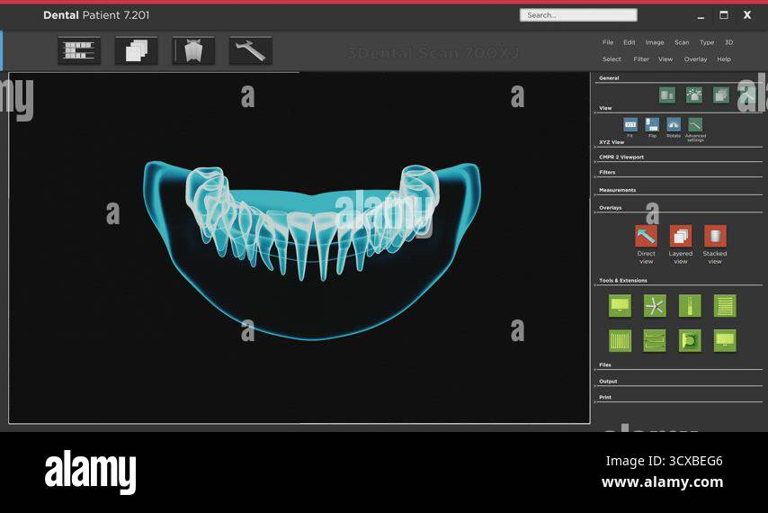 Interface of software app user interface with dental xray scan Stock ...