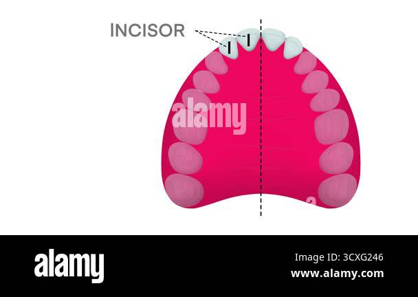 Educational dental chart showing the upper teeth structure with labeled ...