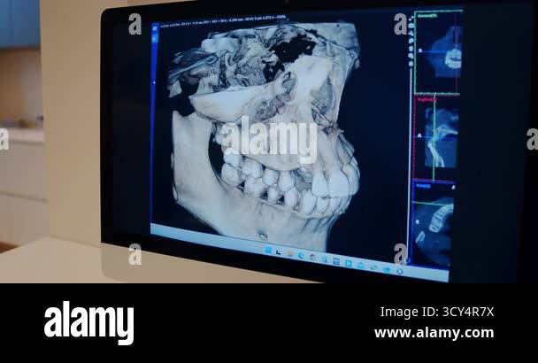 Highly detailed 3D CT scan images provide a comprehensive view of the ...