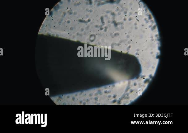 Extreme close needle point moving under an optical microscope. The ...