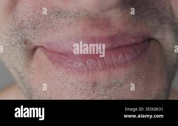 Extreme close-up of a womans mouth with problem skin. Face transitions ...