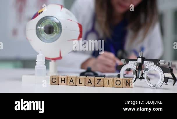 Woman works at desk with Chalazion on blocks eyeball model eye drops ...
