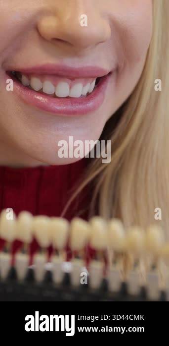 Dental shade matching process, technician uses shade guide to achieve ...
