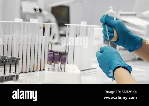 Hematology analysis Stock Videos & Footage - HD and 4K Video Clips - Alamy