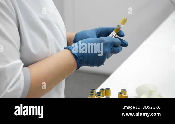 Close up of lab technician hands in gloves applying barcode label on ...