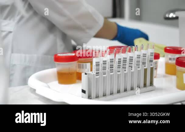 Medical laboratory worker in blue gloves pouring urine samples into ...