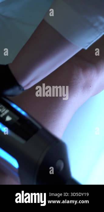 Endospheres Anti-Cellulite Treatment on Legs / Abdomen Stock Video ...