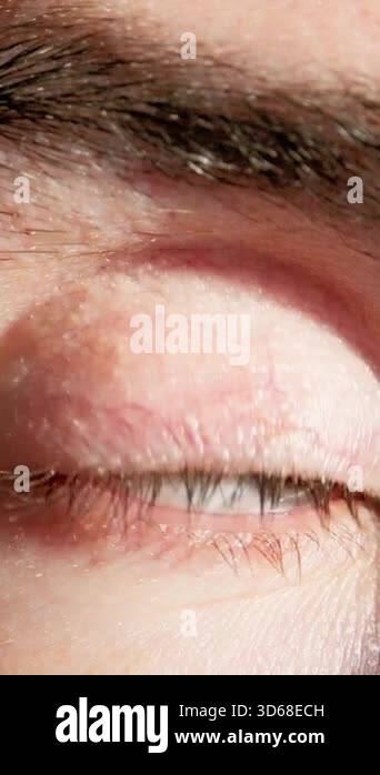 caucasian patient under clinical eye assessment, medical evaluation of ...