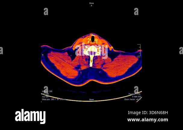 Detailed animation of colorful computed tomography (CT) scan slices ...