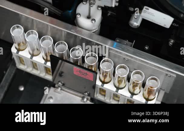 Modern urine analyzer processing urine samples in modern clinical laboratory for medical ...