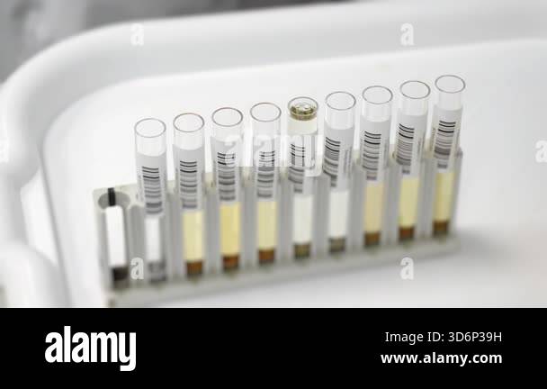 Close up of lab worker pouring urine samples into barcode labeled test ...