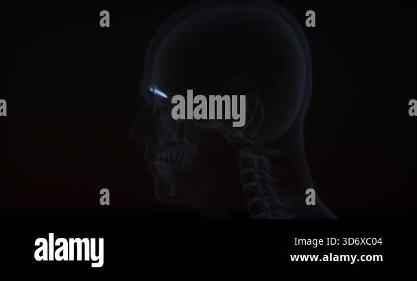Corrugator supercilii muscle in human body. X Ray. Loop Stock Video ...