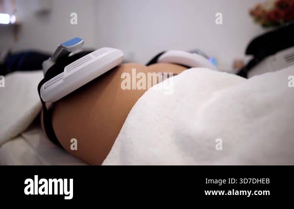 Professional body sculpting procedure using electromagnetic stimulation ...