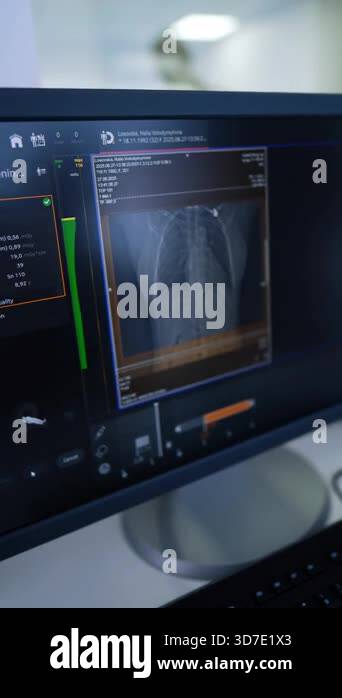 Kyiv, Ukraine, 2 August 2025: CT scan console displaying a preview of ...