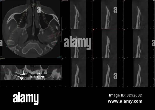 Animation of a dental MRI software screen. Monitoring dental health ...