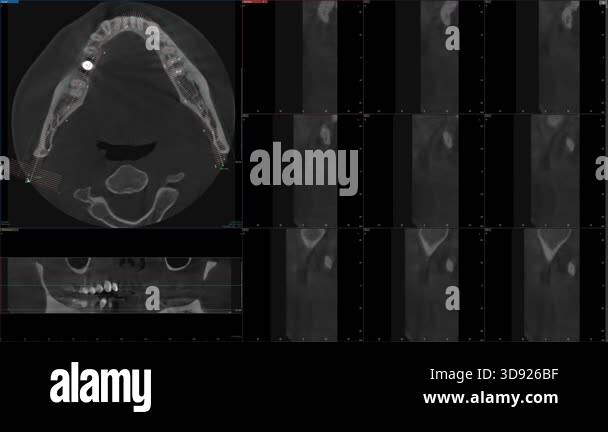 Animation of a dental MRI software screen. Monitoring dental health ...