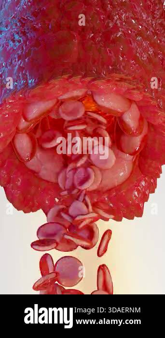 vasoconstriction and vasodilation blood pressure, dilated blood vessels ...