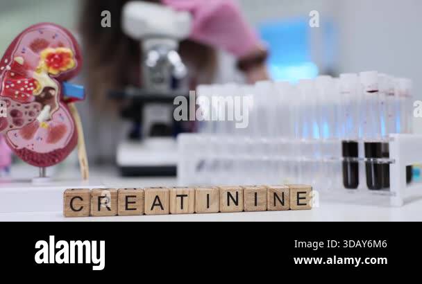 Wooden blocks spell word Creatinine near kidney model on lab table ...